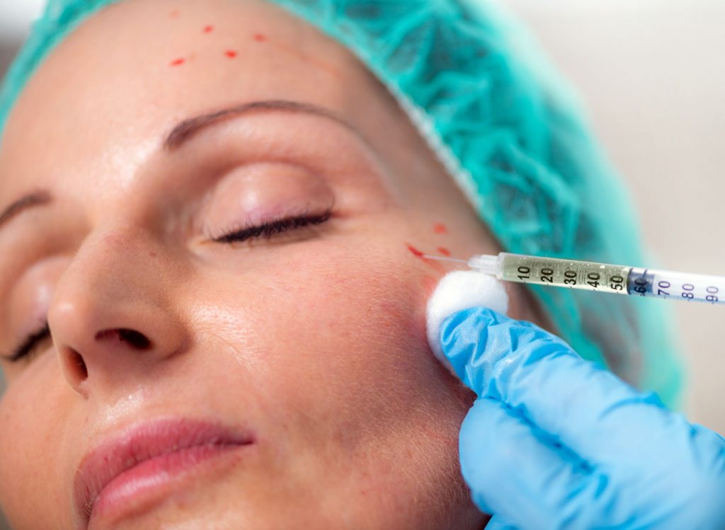 What are the Benefits of Platelet Rich Plasma (PRP) Injection?