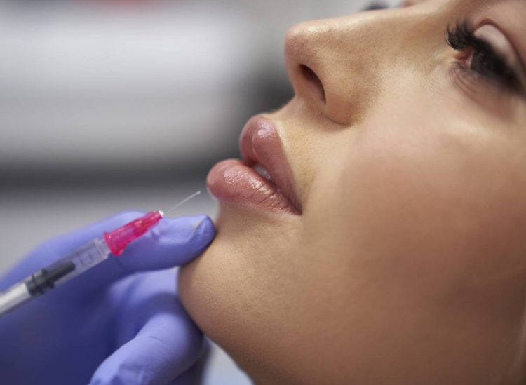 Discovering the Best Botox and Lip Filler Treatments Los Angeles